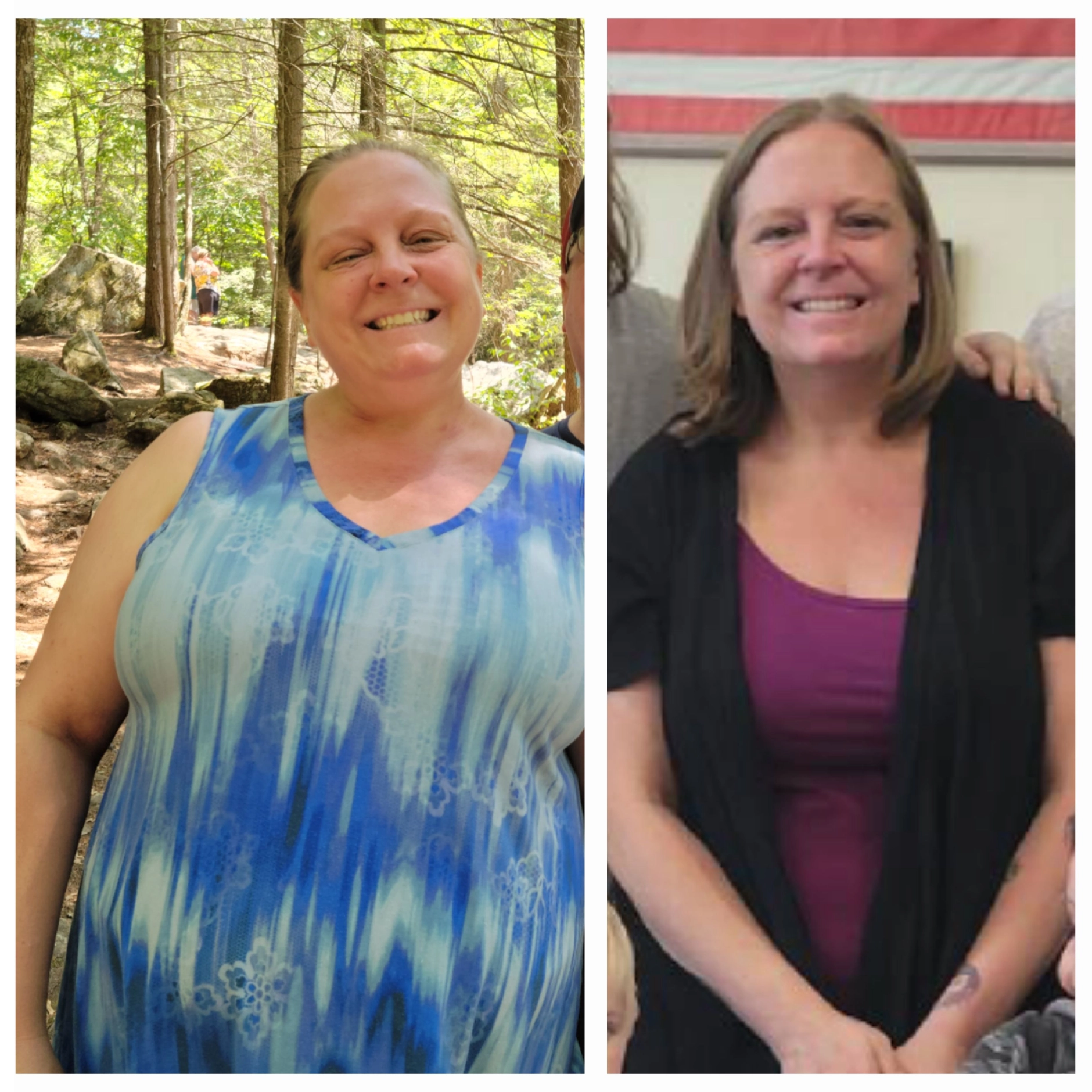 Heather’s Weight Loss Journey | sleeve surgery | Emerson Hospital